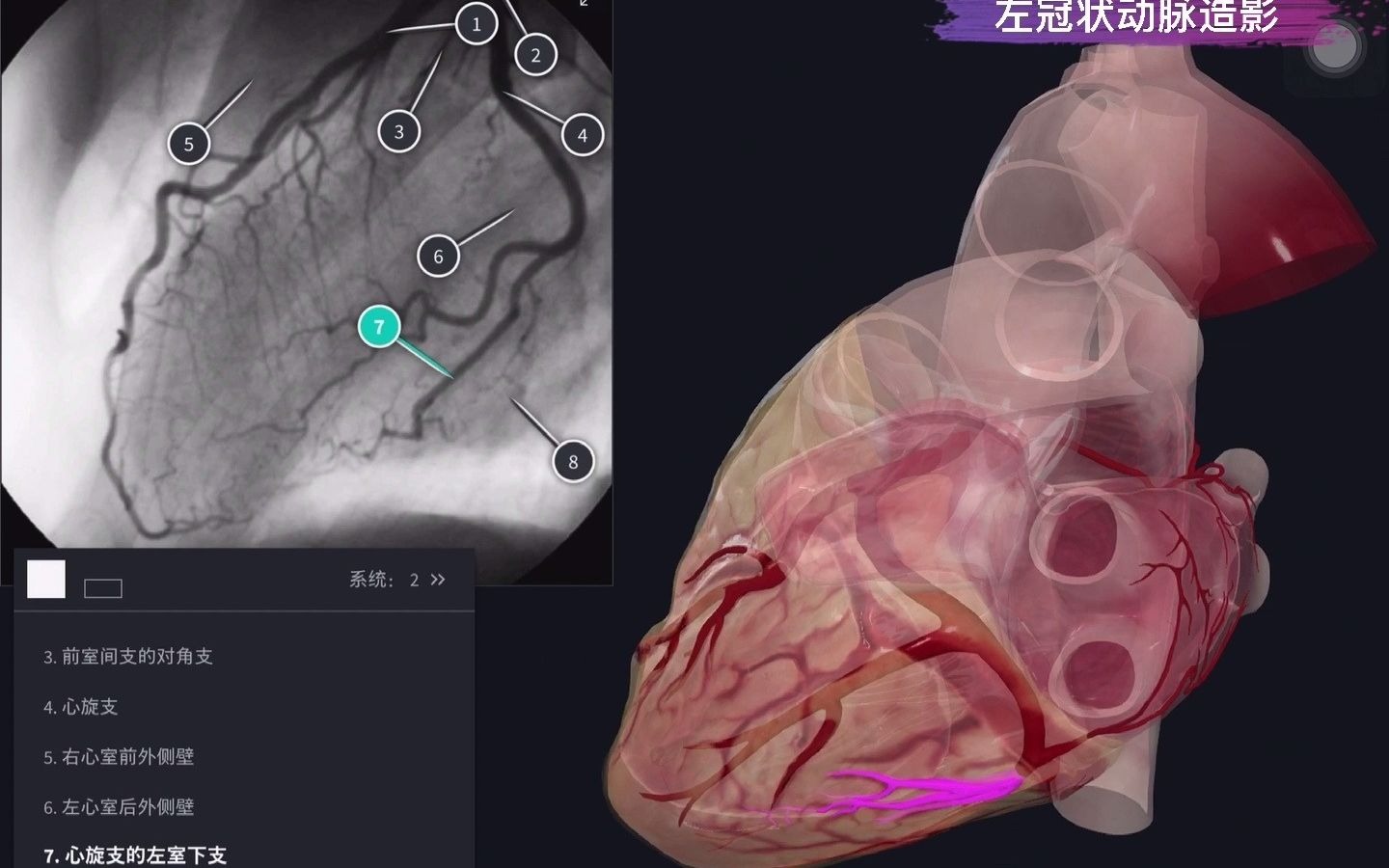 【生活中的解剖】左右冠状动脉造影