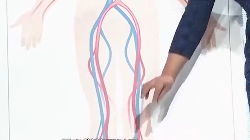 下肢深静脉血栓是如何形成的?发生在哪些部位?一张图教您看懂