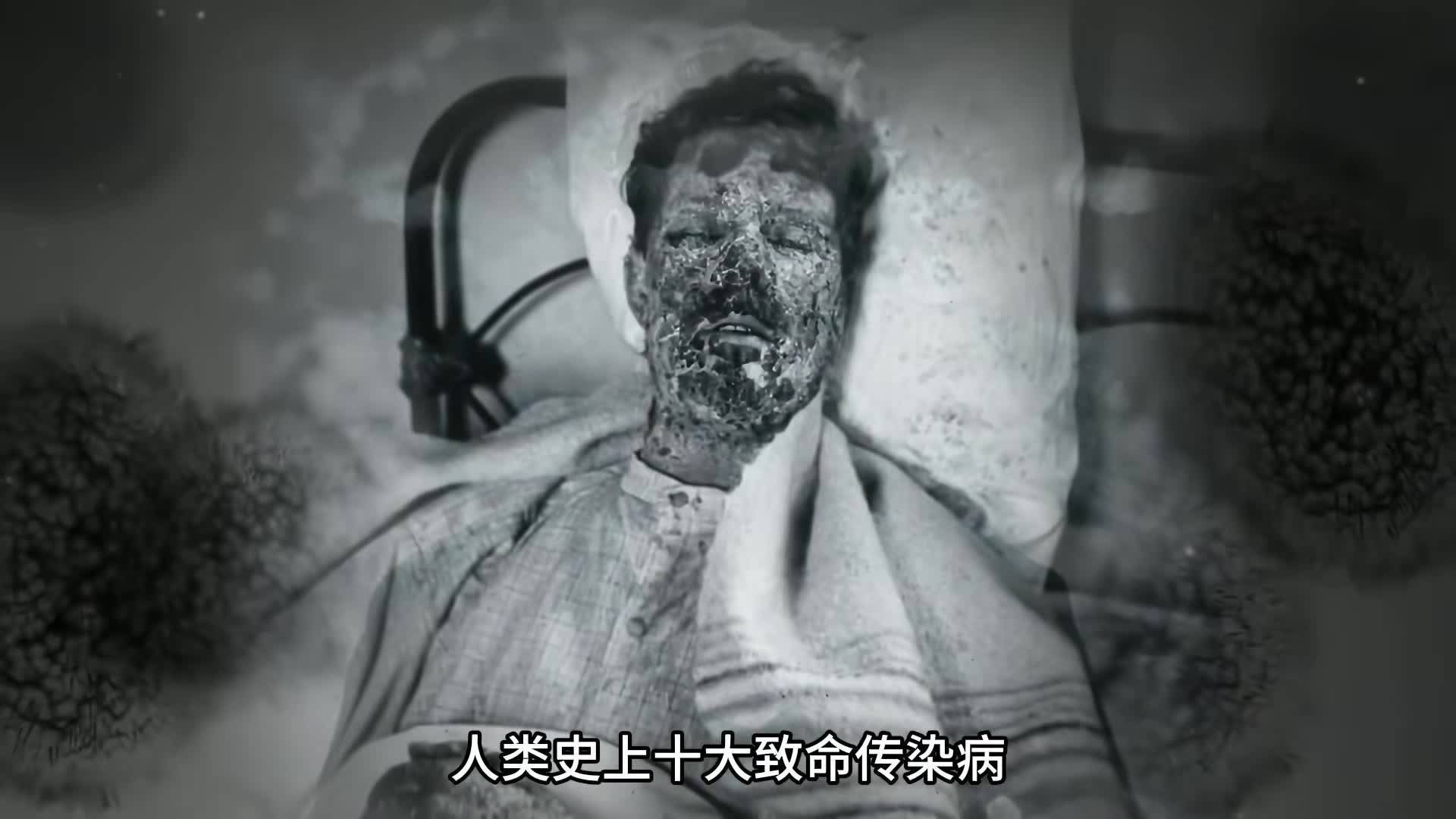 人类史上十大致命传染病排名