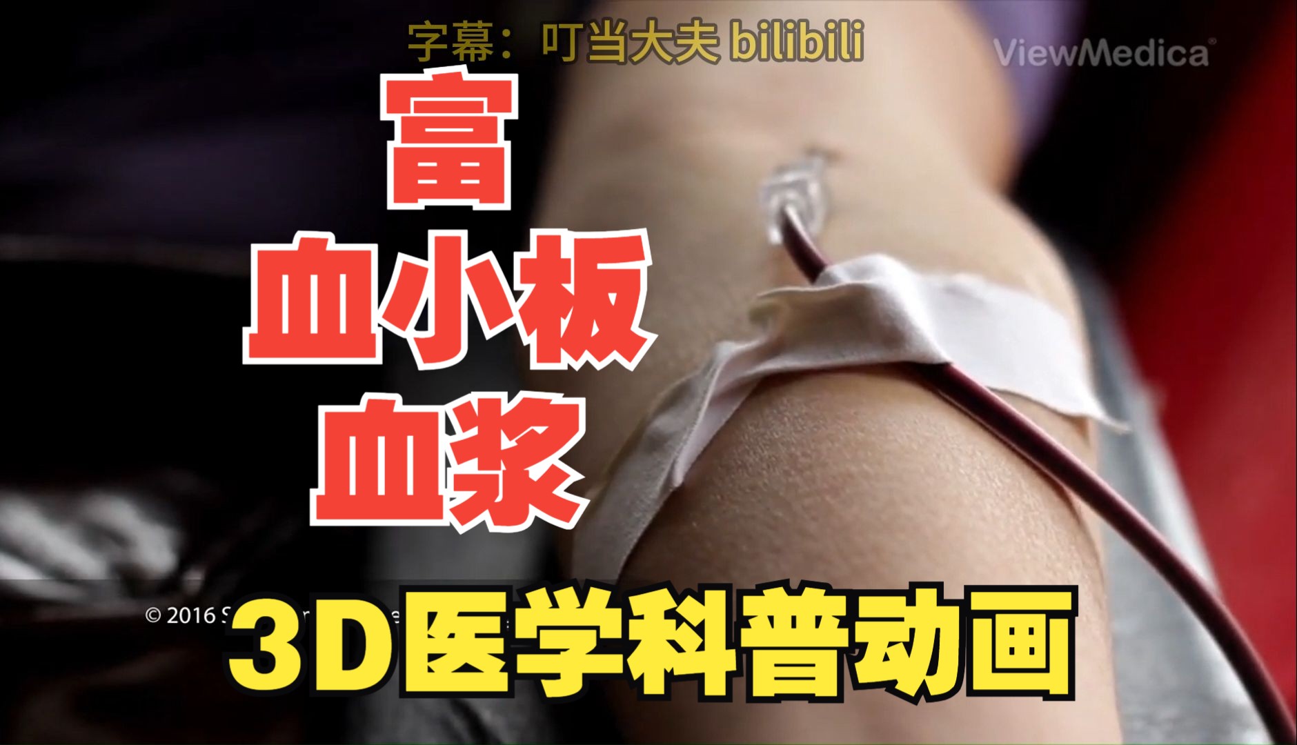 运动员常用,自体创伤修复剂!富血小板血浆疗法(PRP)3D医学科普动画...