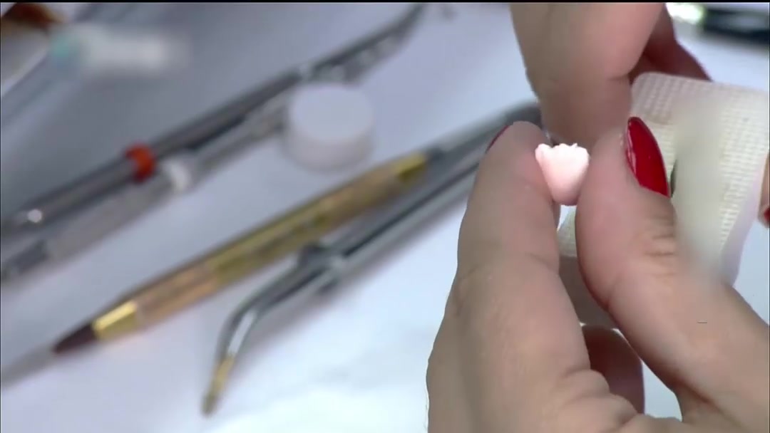 假牙的制造全过程(超高清版)