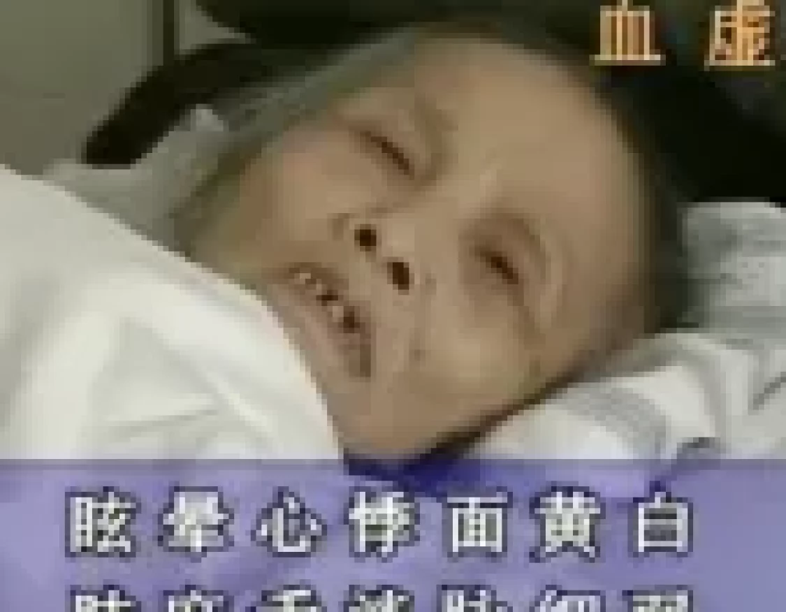 深圳按摩_特色针灸②