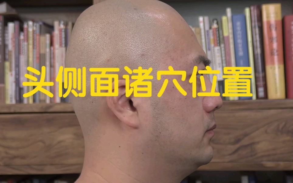 头侧面穴位