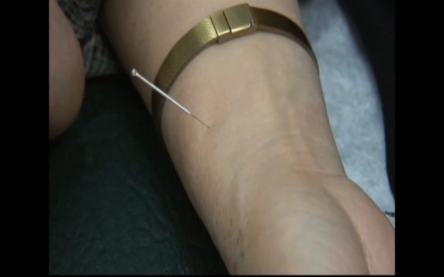 喉咙疾病 倪海厦 列缺 照海 天突 下针教学