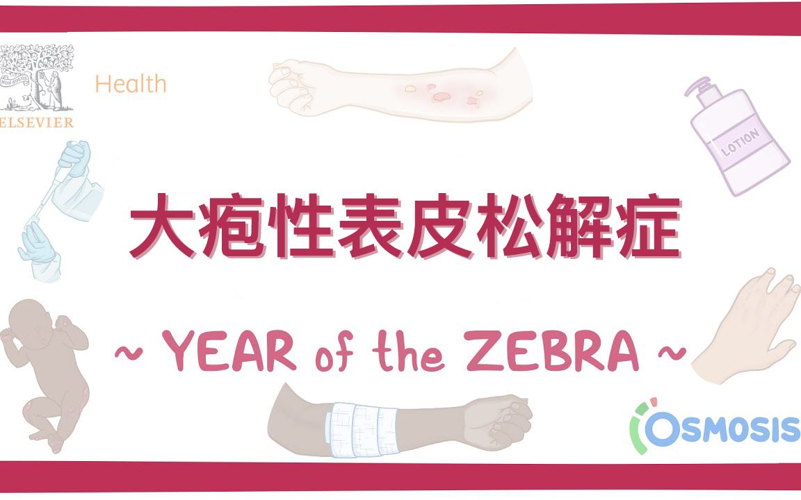 大疱性表皮松解症:轻轻一擦就起水疱,皮肤极度脆弱的痛苦“绝症”