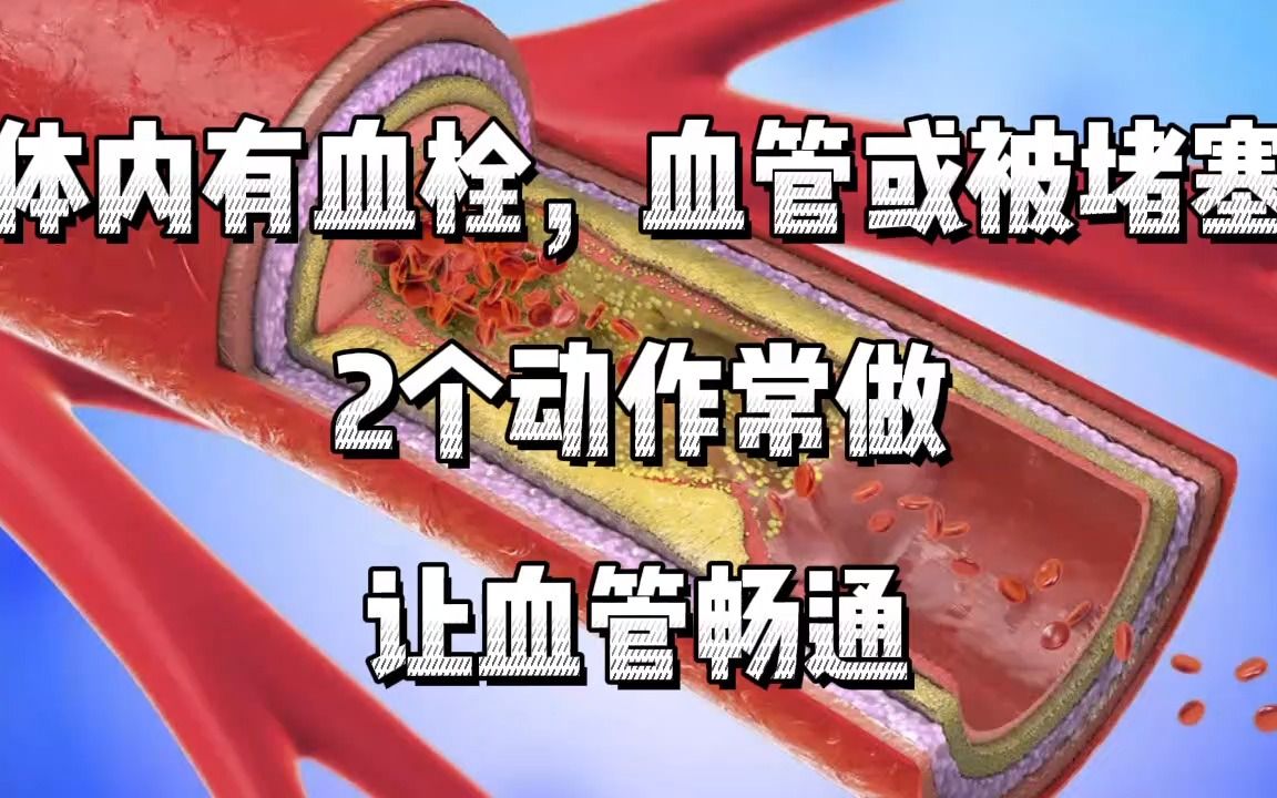 体内有血栓,血管或被堵塞,2个动作常做,让血管畅通