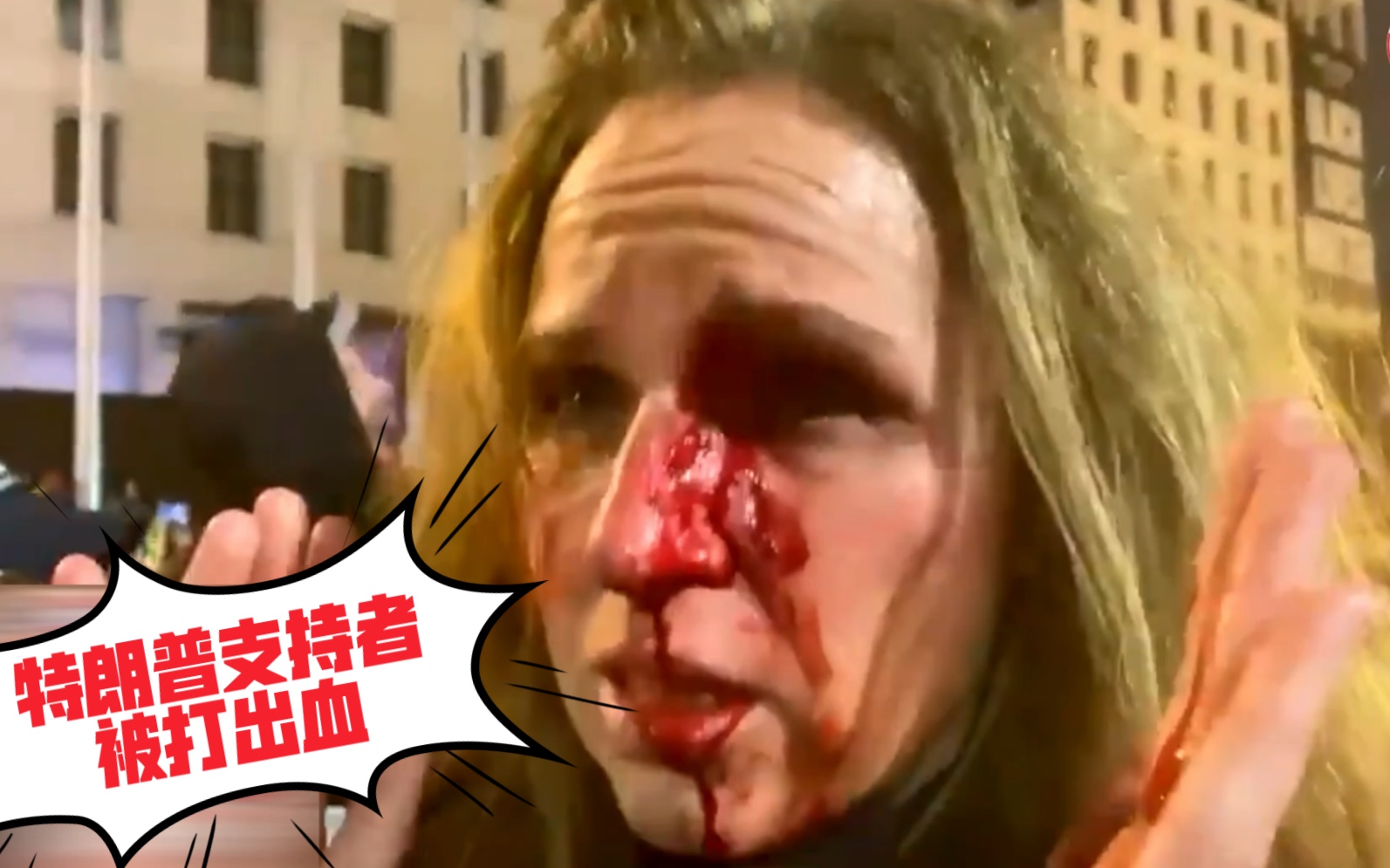 华盛顿冲突爆发!特朗普女性支持者被殴打致面部出血