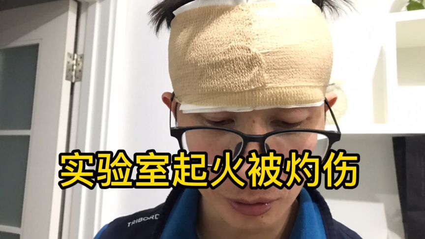 南京航空航天实验室爆炸,第二天老公实验室起火被灼伤,感慨颇多