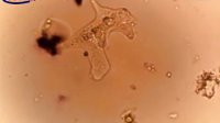 【变形虫】爱科学儿童显微镜拍摄的水中微生物变形虫视频