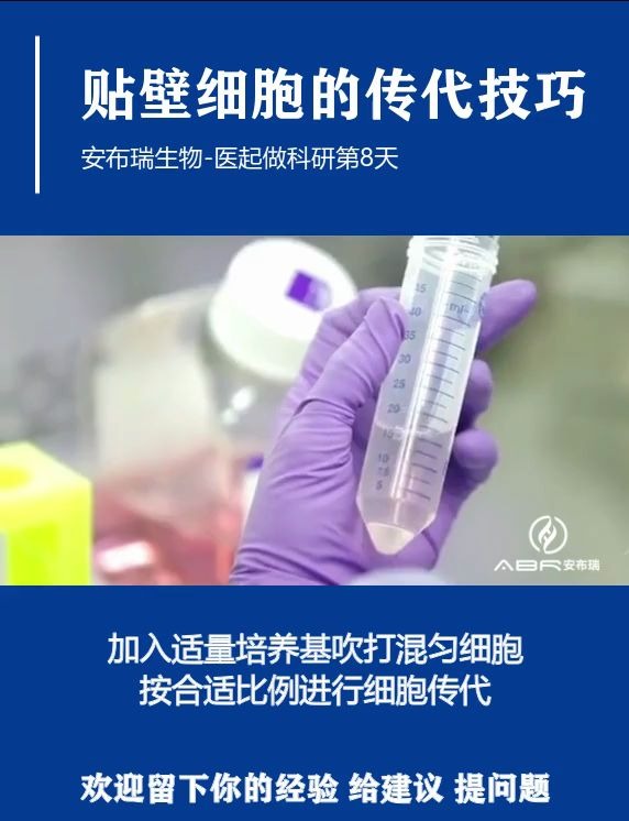 贴壁细胞的传代技巧