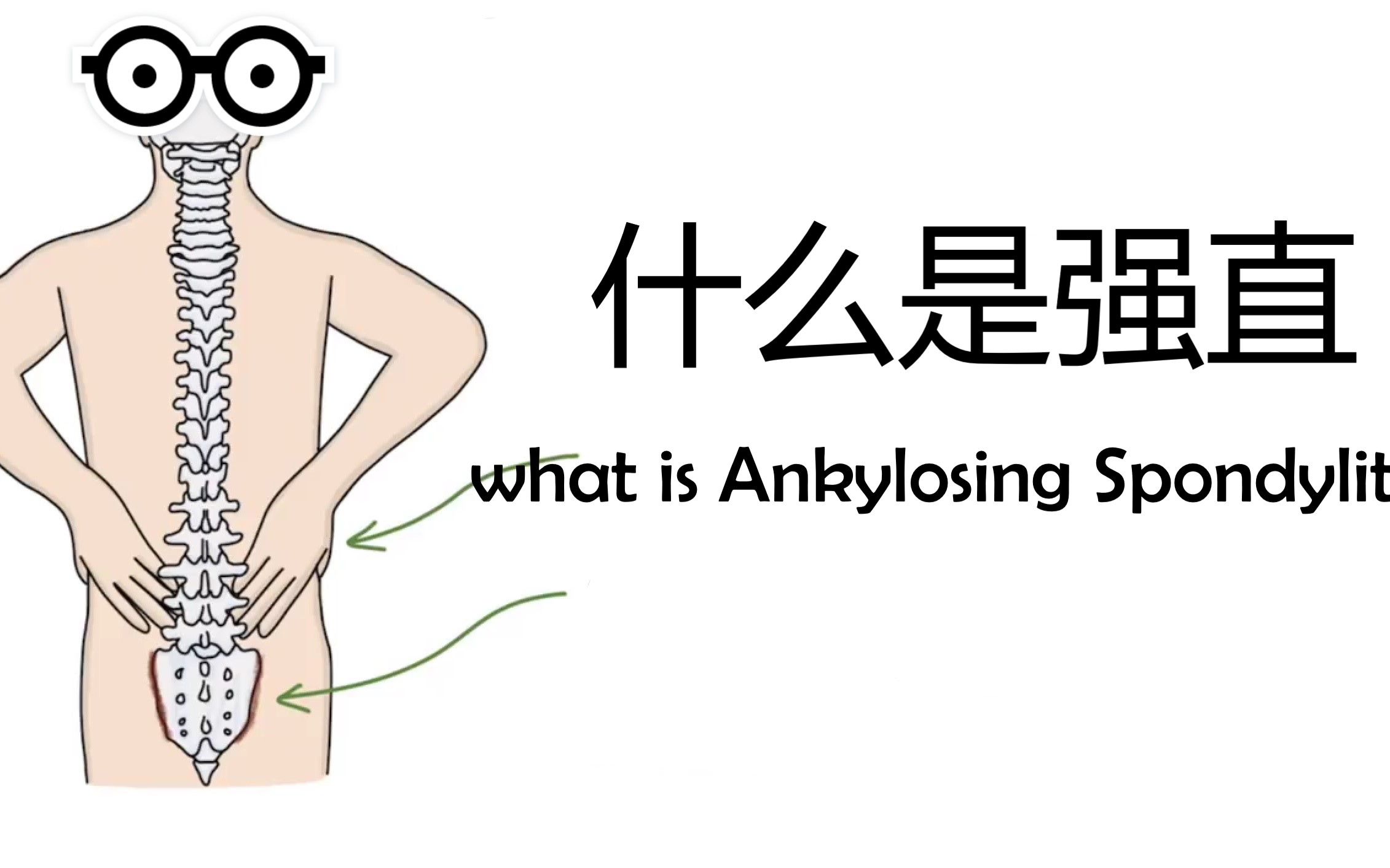 通过医学生的角度了解强直,什么是强直性脊柱炎?