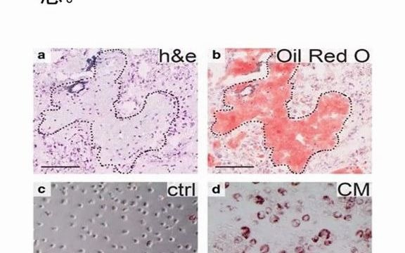 ...这篇IF4.254《乳突状肾细胞癌趋化素、IL-8和CXCL16促进单核细胞...