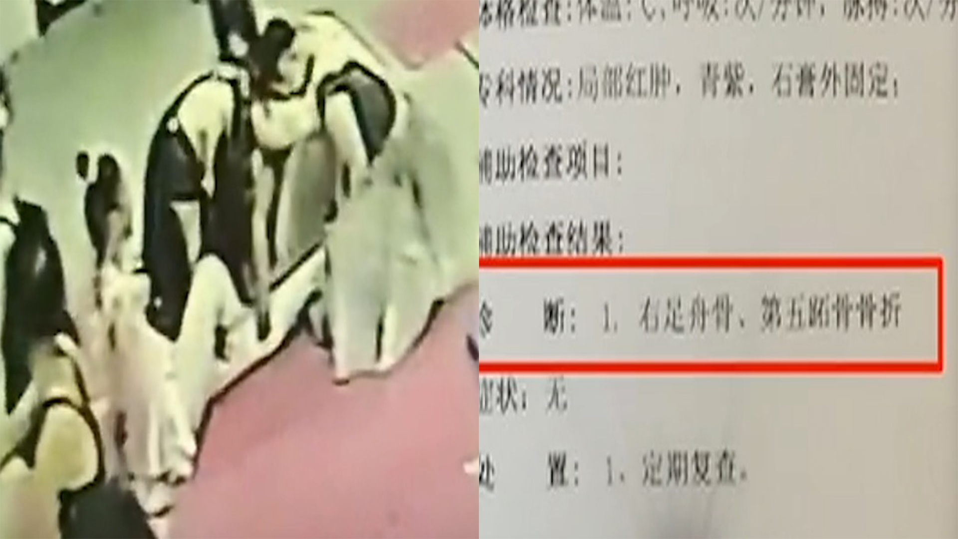 9岁女孩舞蹈课被老师压脚背压骨折,妈妈索赔3万元:老师不专业