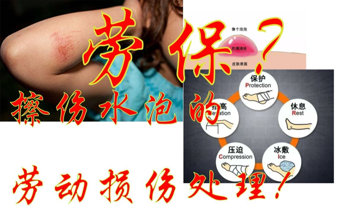 【常见劳动损伤】水泡、擦伤、扭伤、拉伤的处理方法