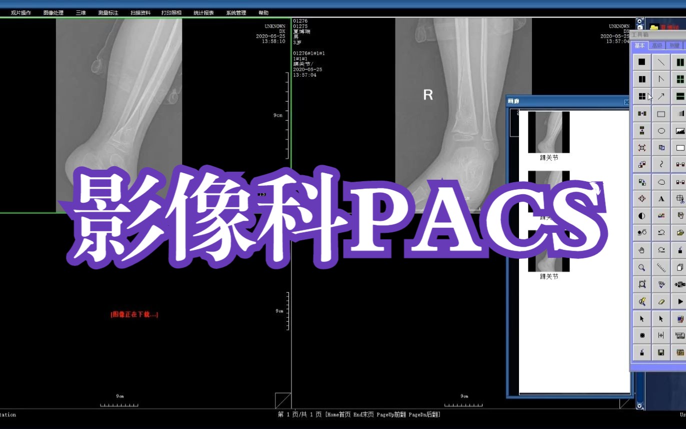 医院PACS系统 VC++ 三维重建