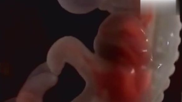 如果你对胎儿的形成一知半解,实拍视频告诉你这个神奇的过程