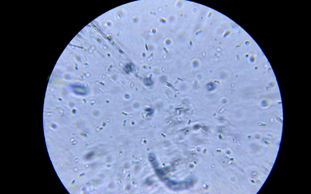 2500倍显微镜看到了细菌