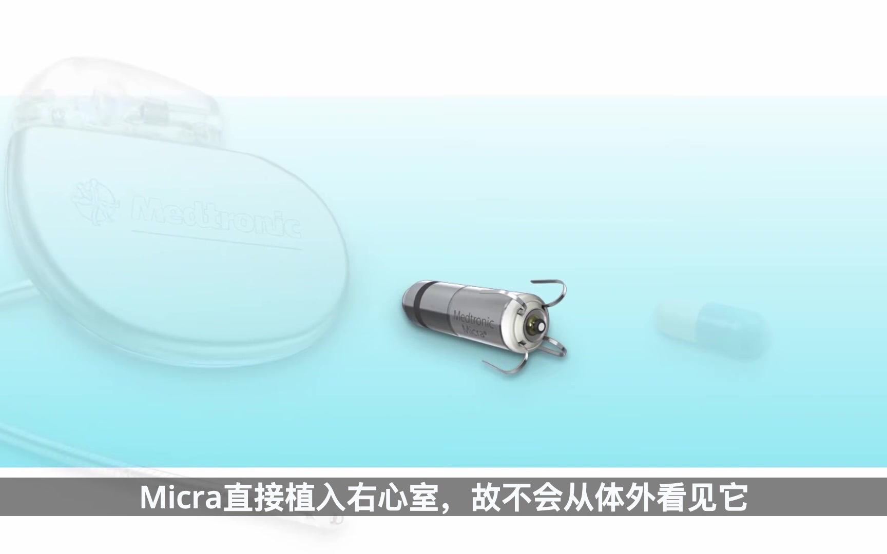 【手术纪念+科普动画】Micra无导线起搏器-闵中心首例