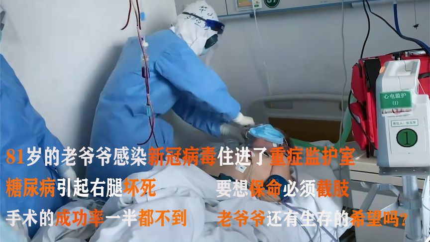 81岁的老爷爷感染新冠病毒,住进 了重症监护室,闯过一关又一关