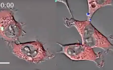 细胞程序性死亡三部曲:凋亡#apoptosis、焦亡#necroptosis和坏死#...