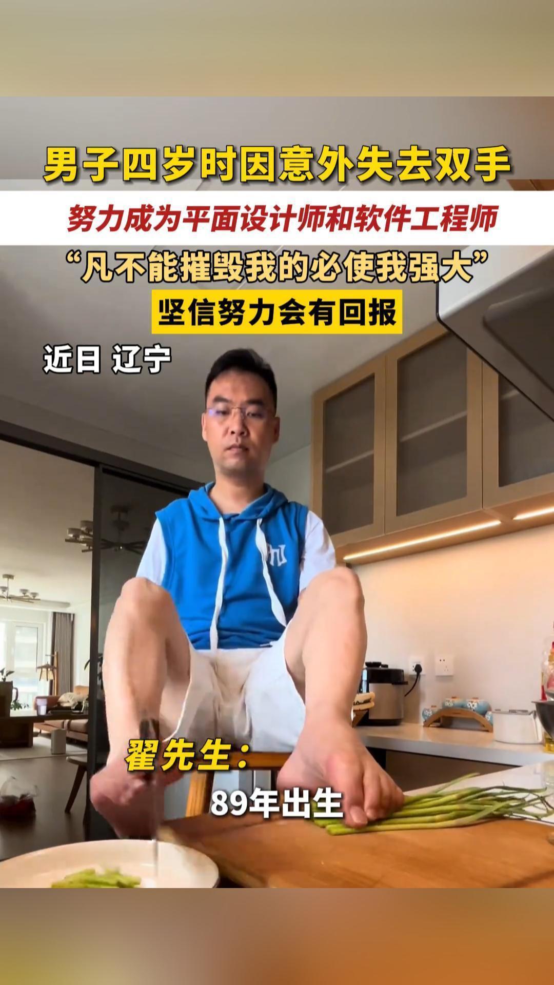 男子四岁时因意外失去双手,努力成为平面设计师和软件工程师
