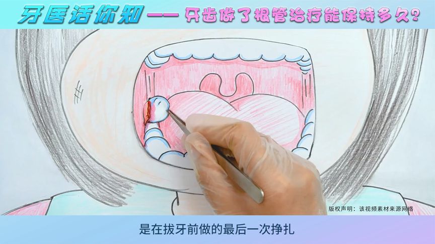 花了大价钱做的牙齿根管治疗,能保持多久?