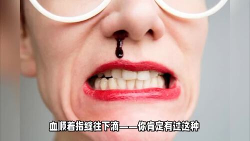 别再仰头塞纸巾!流鼻血急救指南,医生教你3步科学止血