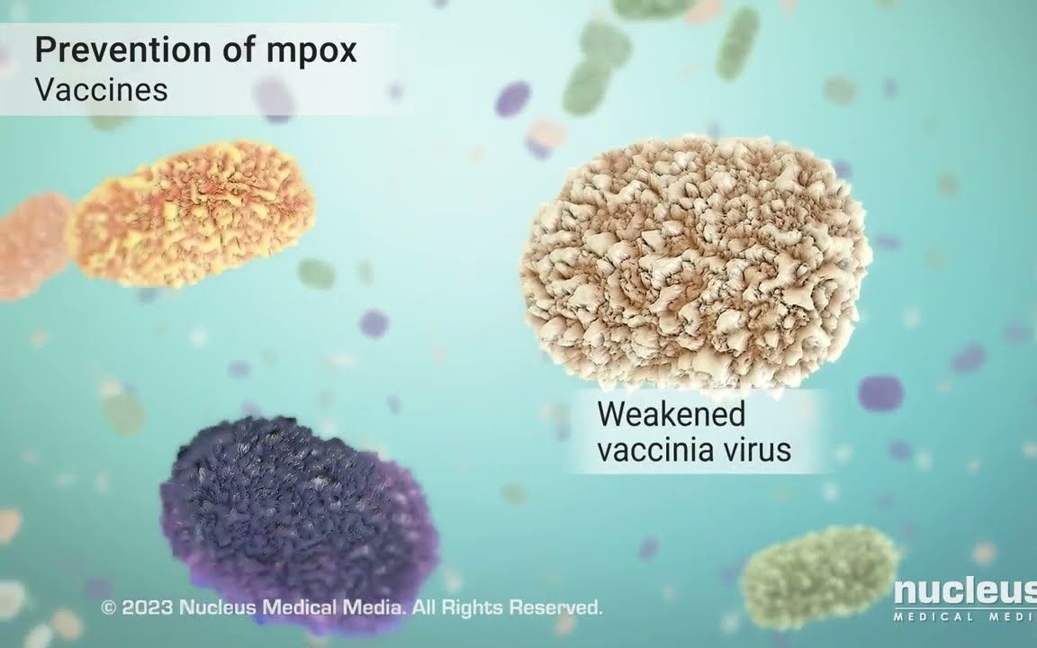 猴痘 (Mpox) 的治疗和预防