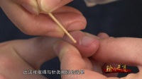 少冲穴-中医提神醒脑之法