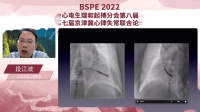 段江波:无导线起搏器植入案例分享