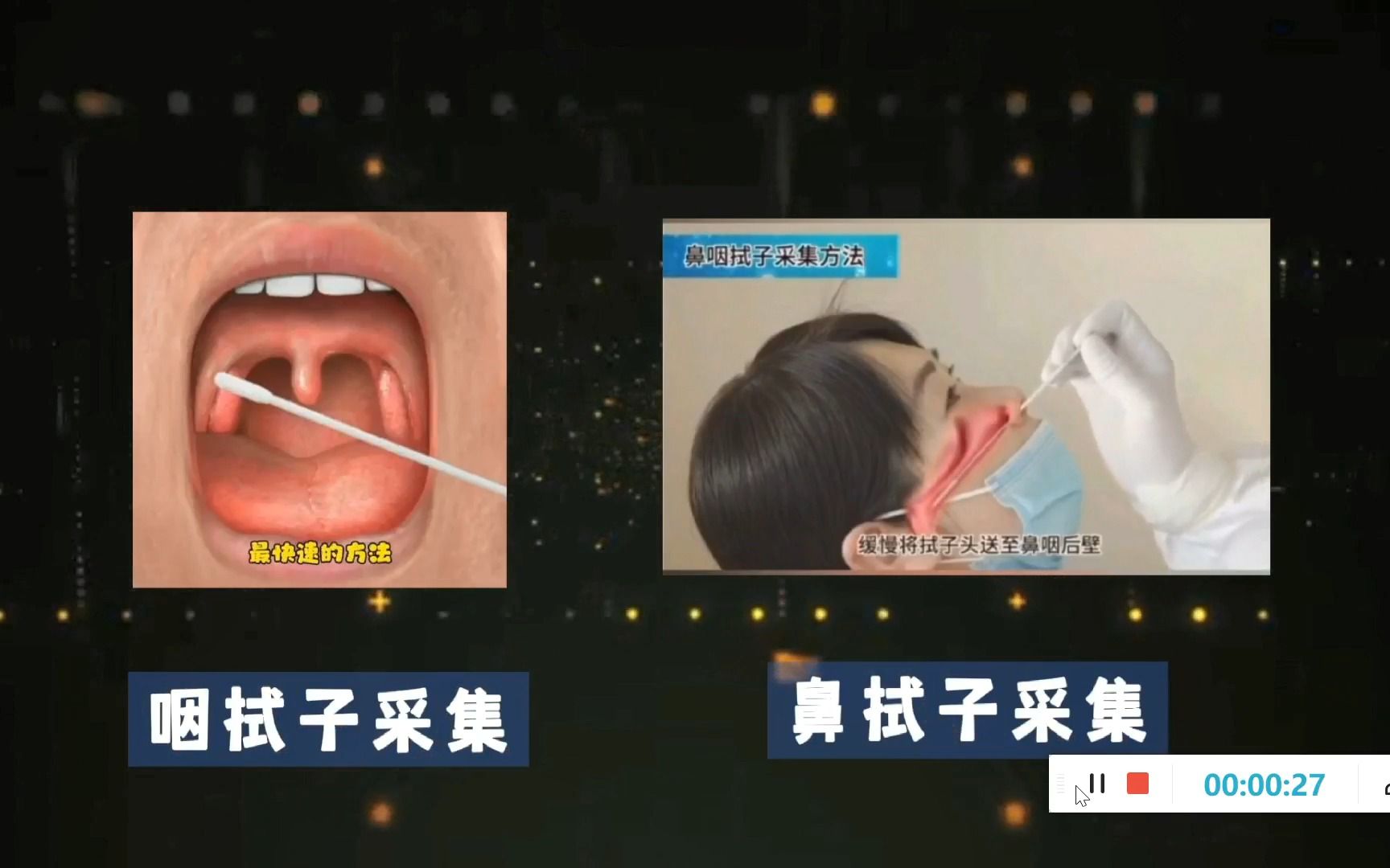 新冠胶体金检测方法1