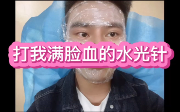 水光针操作全流程