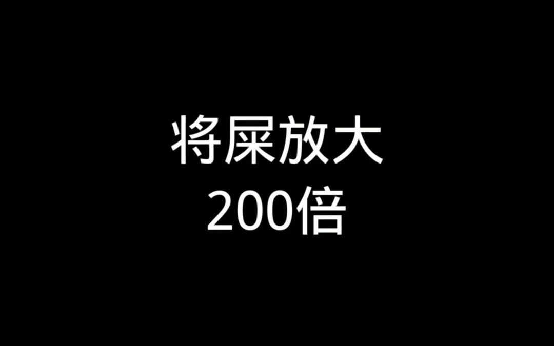 显微镜下将屎放大200倍是什么样子?