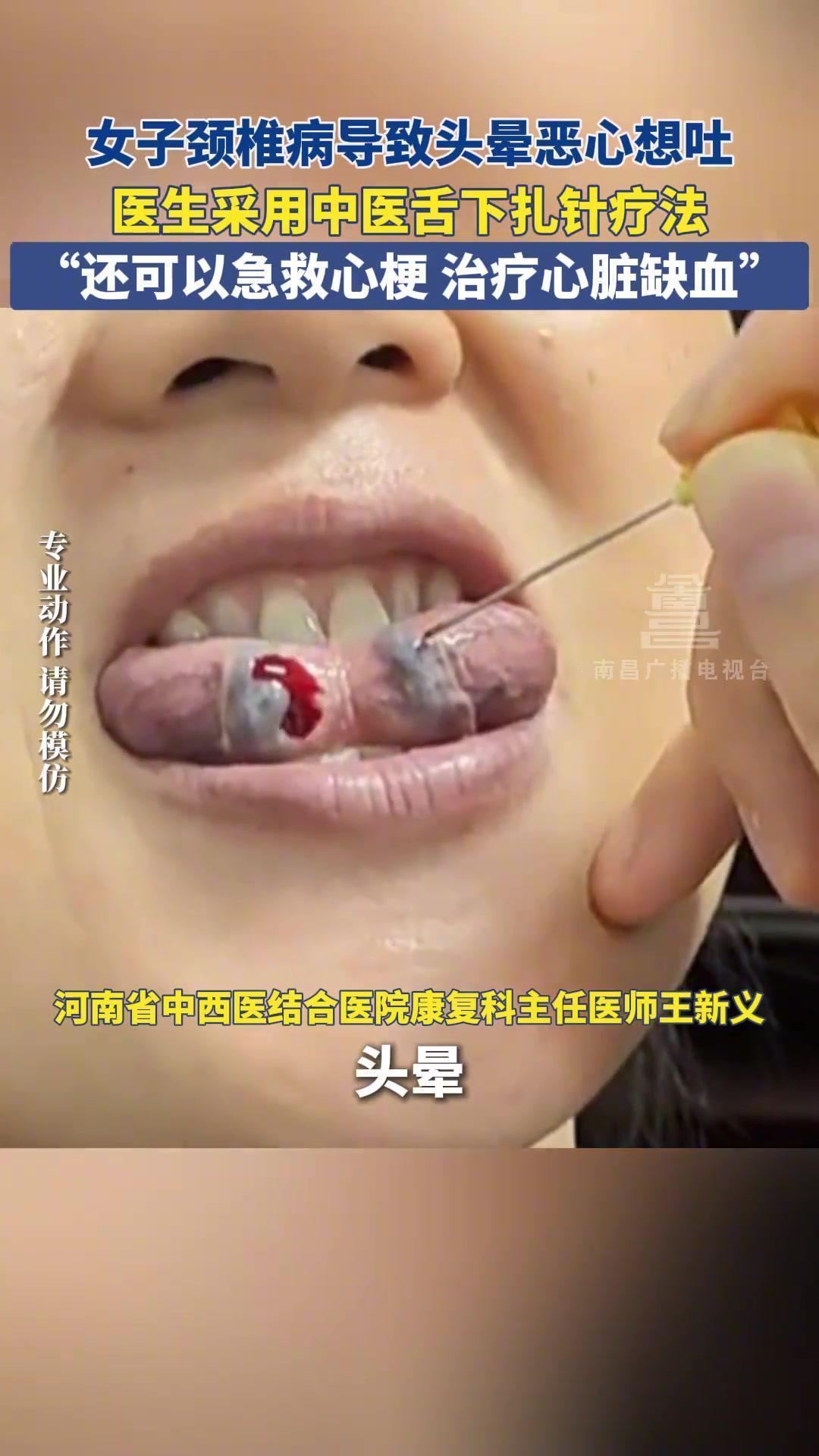 10月9日,河南郑州。女子颈椎病导致头晕恶心想吐,体内湿热比较大,...