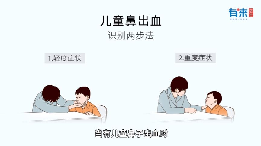 儿童鼻出血处理方法 #急救指南 #家庭生活
