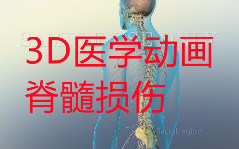 脊髓损伤讲解-3D医学动画