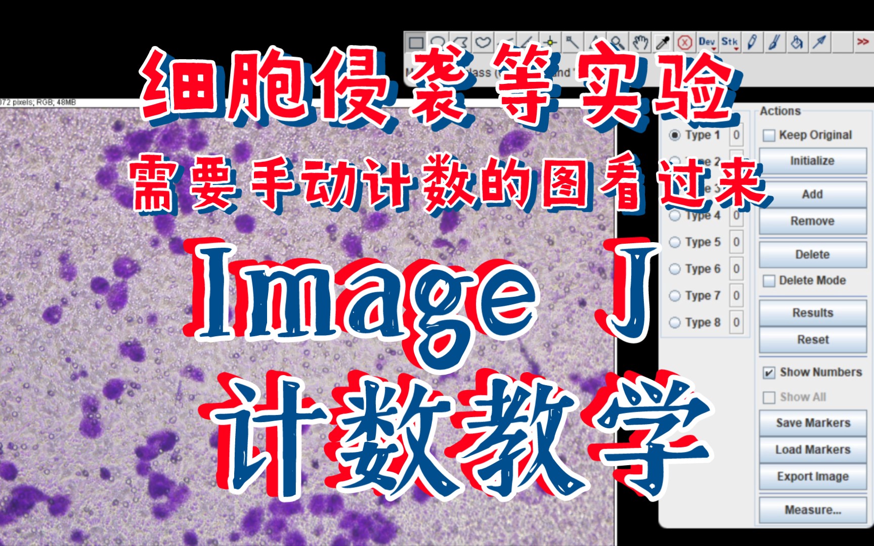细胞侵袭实验技术方法!Image J手动记数法!简单明了!学一下吧!