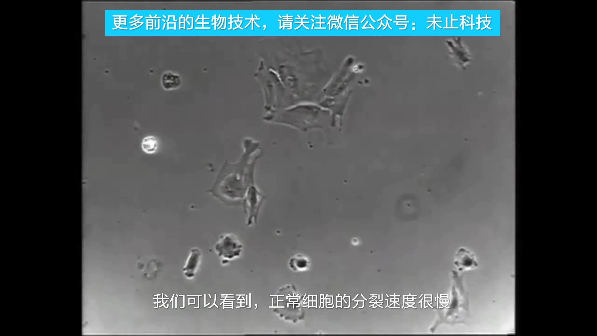 【误入】洗脑视频再现,用高倍显微镜观察癌细胞在人体内的狰狞面目,...