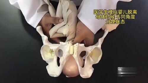 模拟胎儿分娩时候的状态