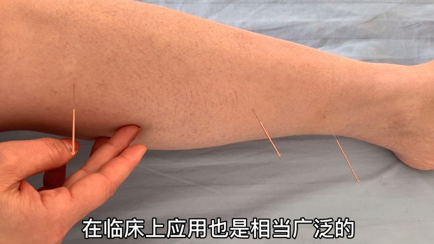 董氏奇穴:滋阴补肾,下三皇可三针齐下