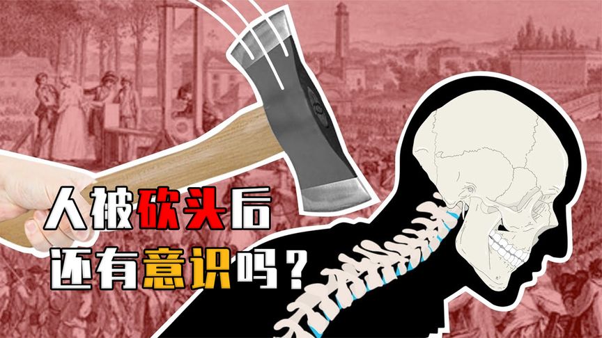 颠覆你认知的大脑秘密:人被砍头后还有意识吗?无脑人如何生活?