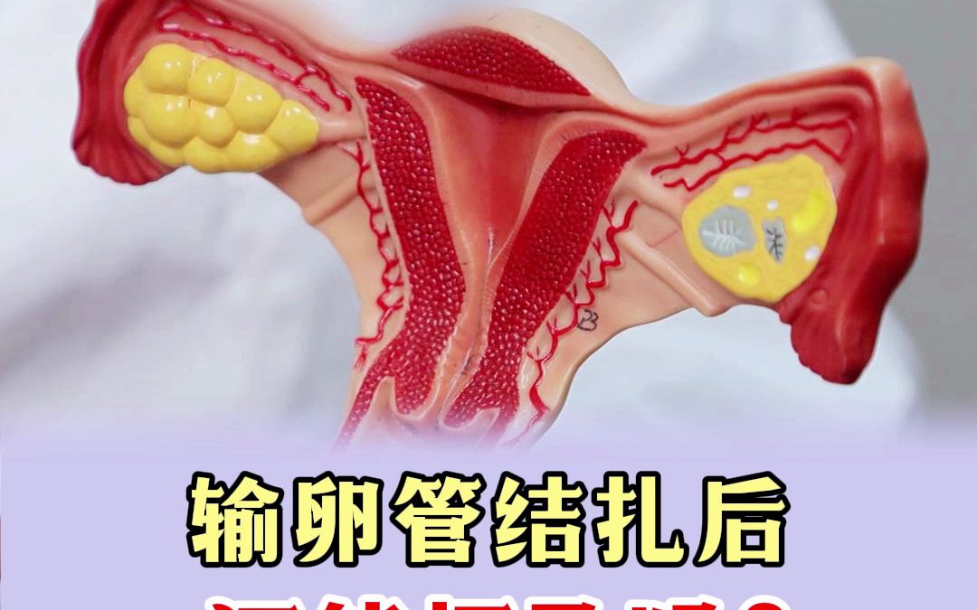 输卵管结扎后 还能怀孕吗?