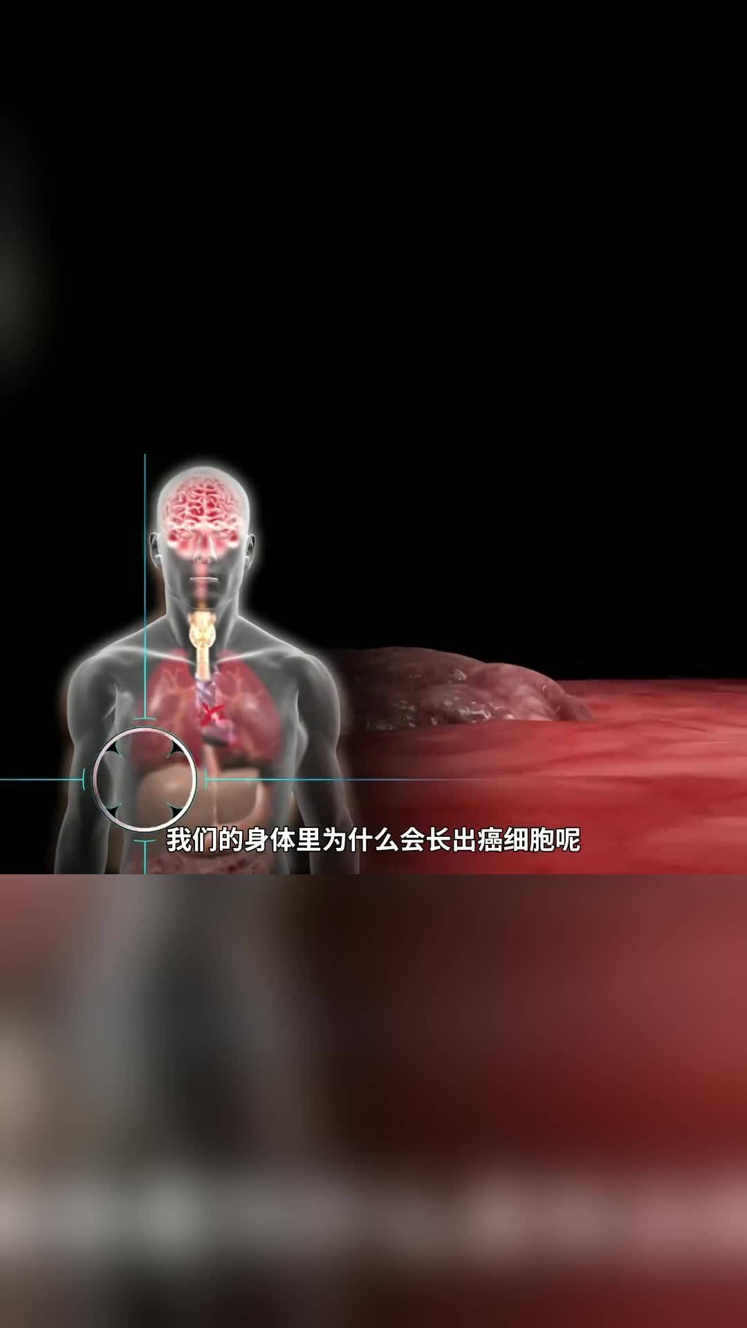 动漫:癌症如何形成?为何癌症越来越年轻化?