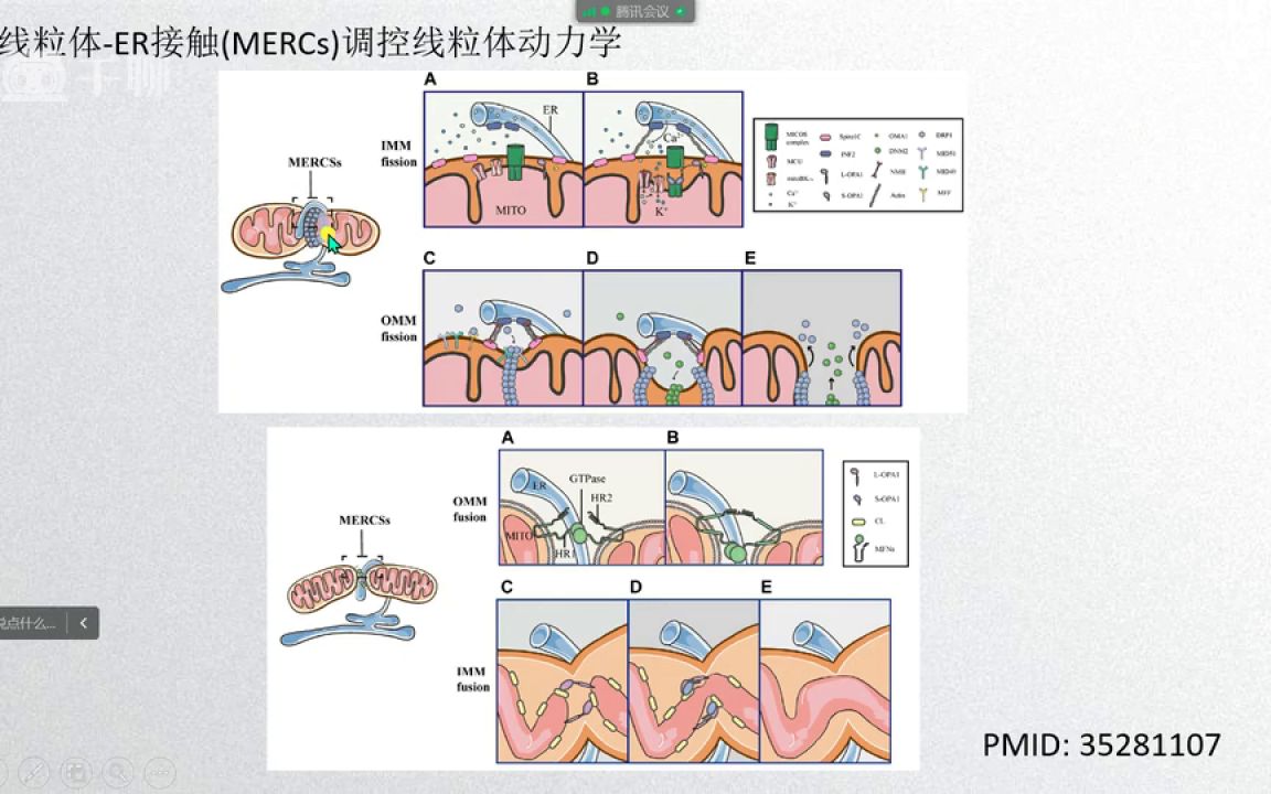 零基础学:脑血管DSA造影操作流程医学会员免费学