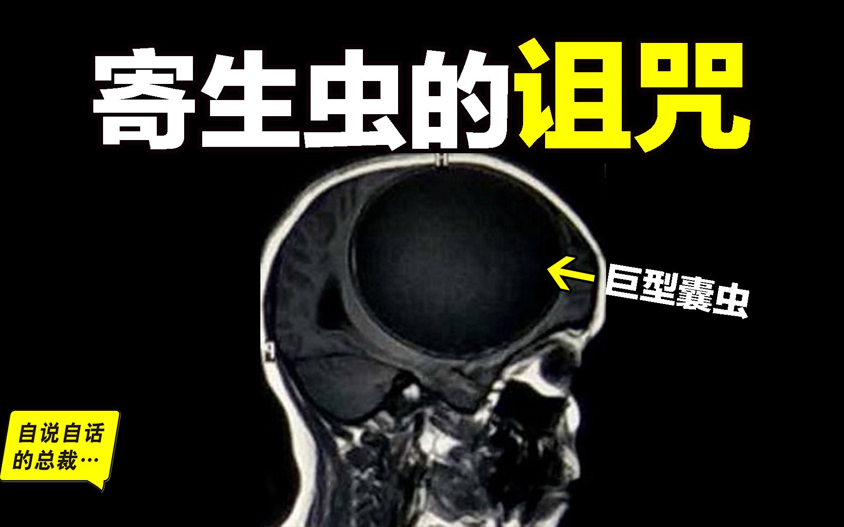 ...的秘密,原来,寄生虫使用了一个三角诅咒来控制人类…|自说自话的总裁