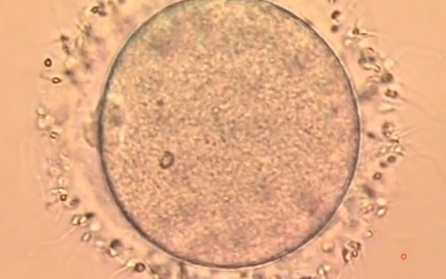 自然受精VS保送
