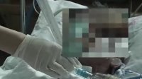 气管切开与密闭式吸痰.rm