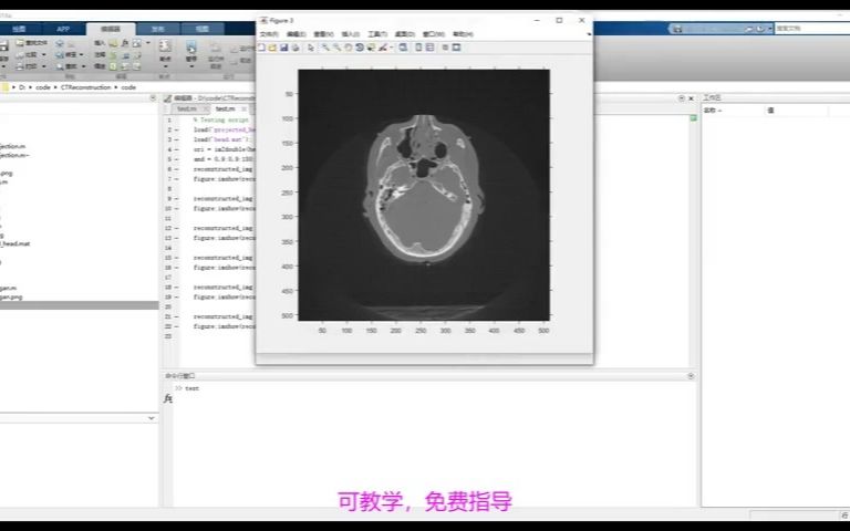 基于Matlab编写的CT图像重建算法(教学)