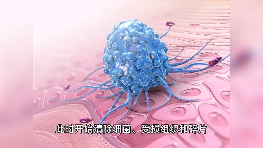 组织修复:伤口是如何愈合的?身体是怎样自我修复的?