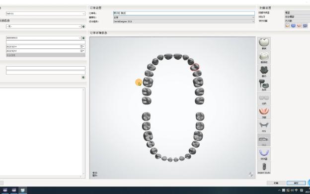 3shape修复口扫模型修边冠一体 模型编辑
